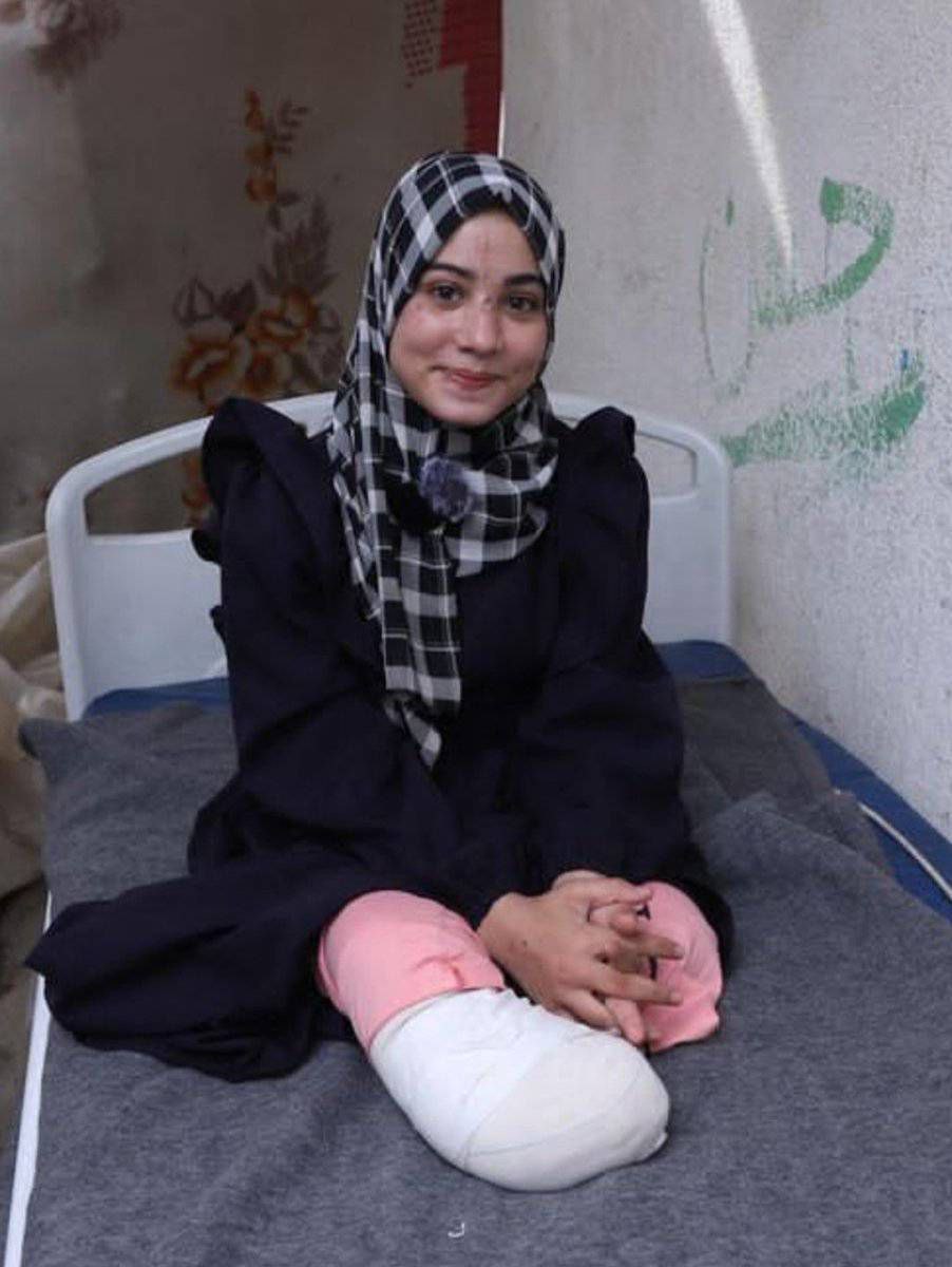 آخرین خبر عکس لبخند امید بخش دختر فلسطینی که پاهایش قطع شده است